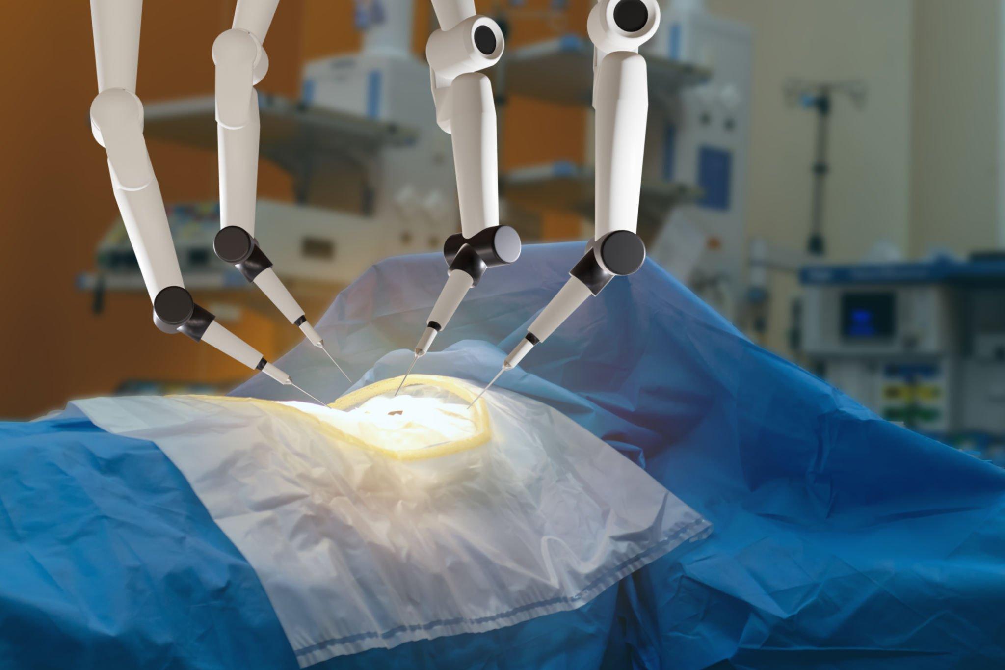 Robotic Surgery for Appendicitis